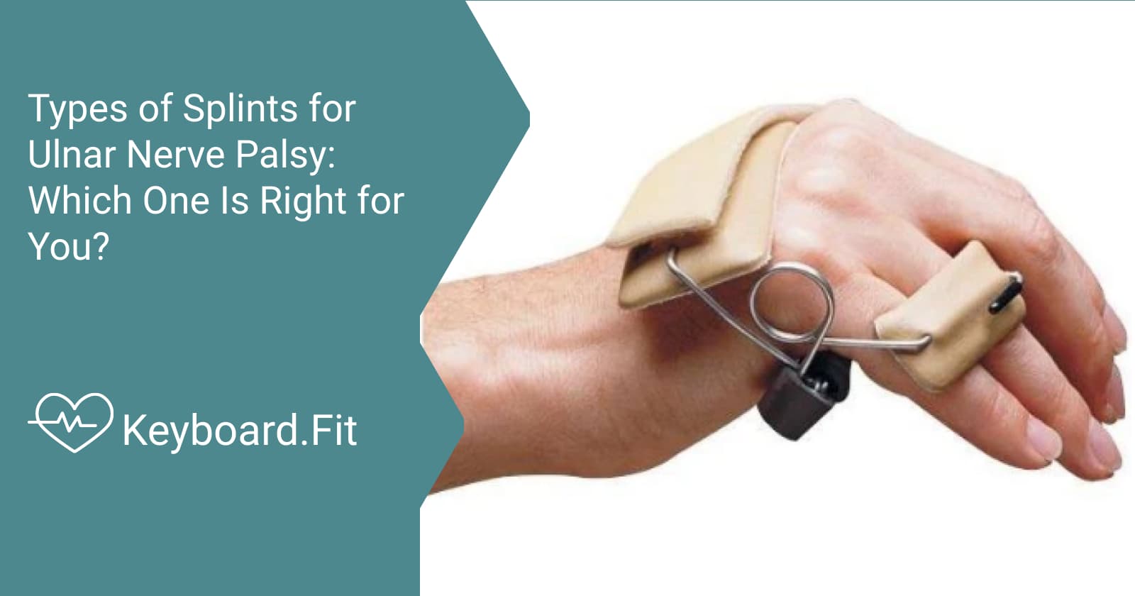 Types of Splints for Ulnar Nerve Palsy: Which One Is Right for You ...