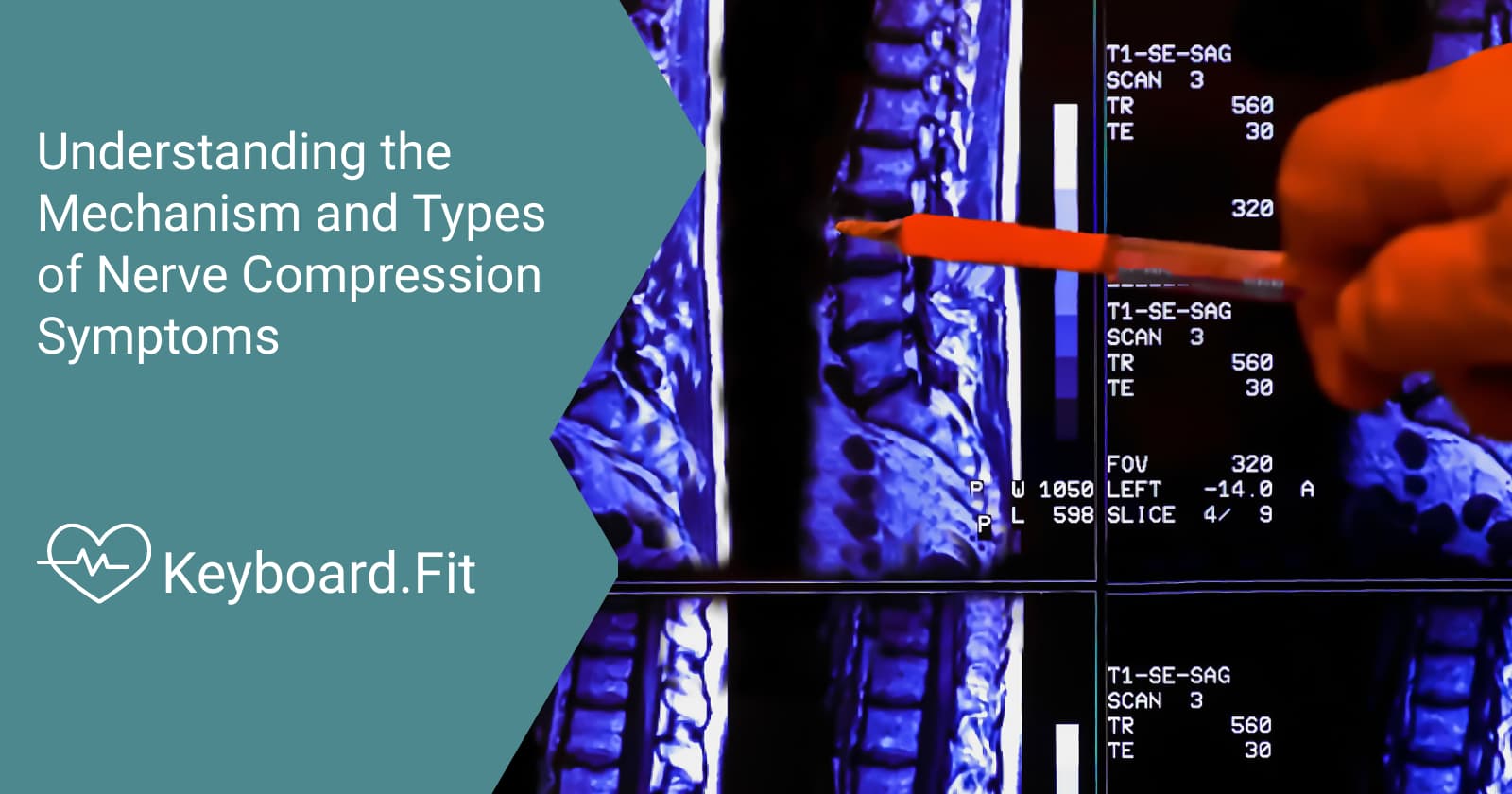 Beneath the Surface: Understanding the Mechanism and Types of Nerve ...