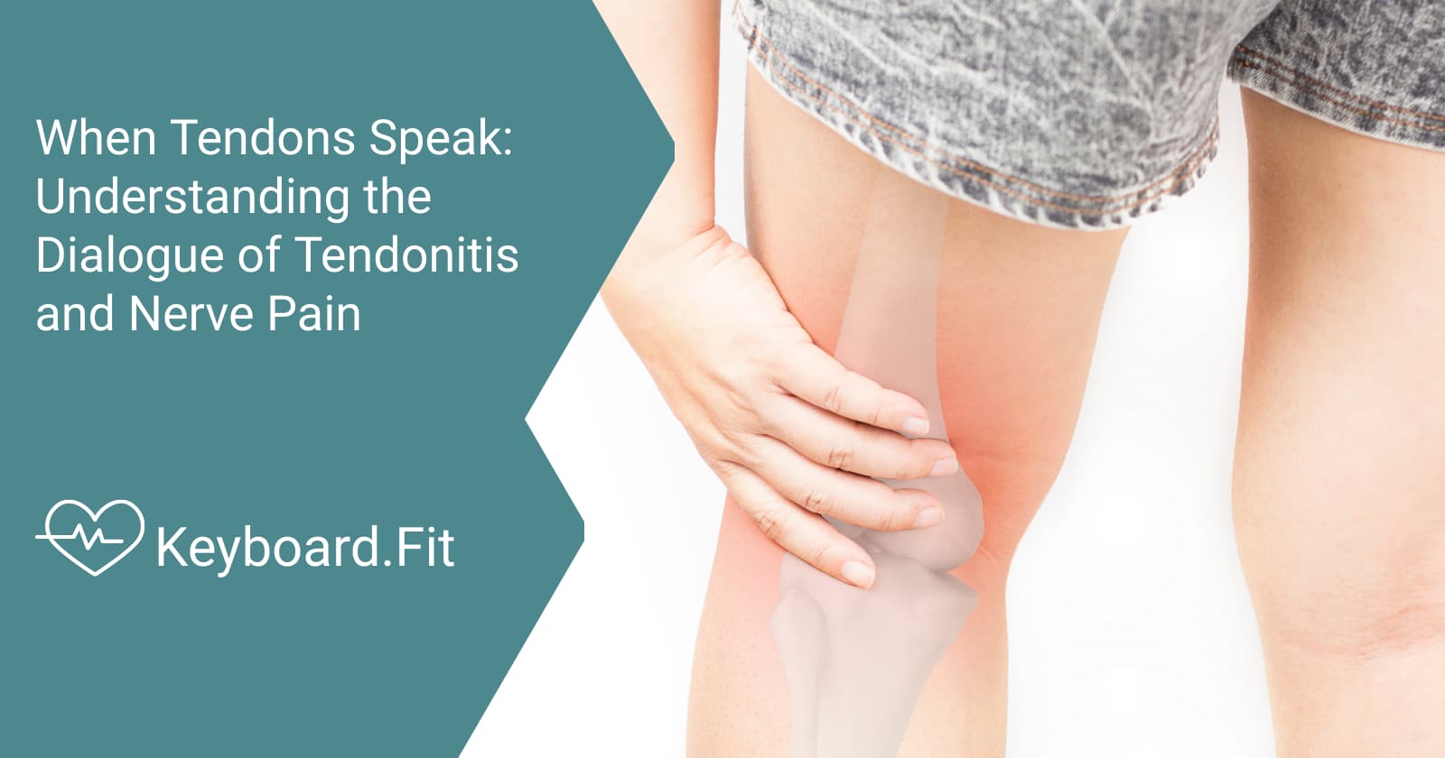 When Tendons Speak: Understanding the Dialogue of Tendonitis and Nerve Pain - Keyboard.Fit